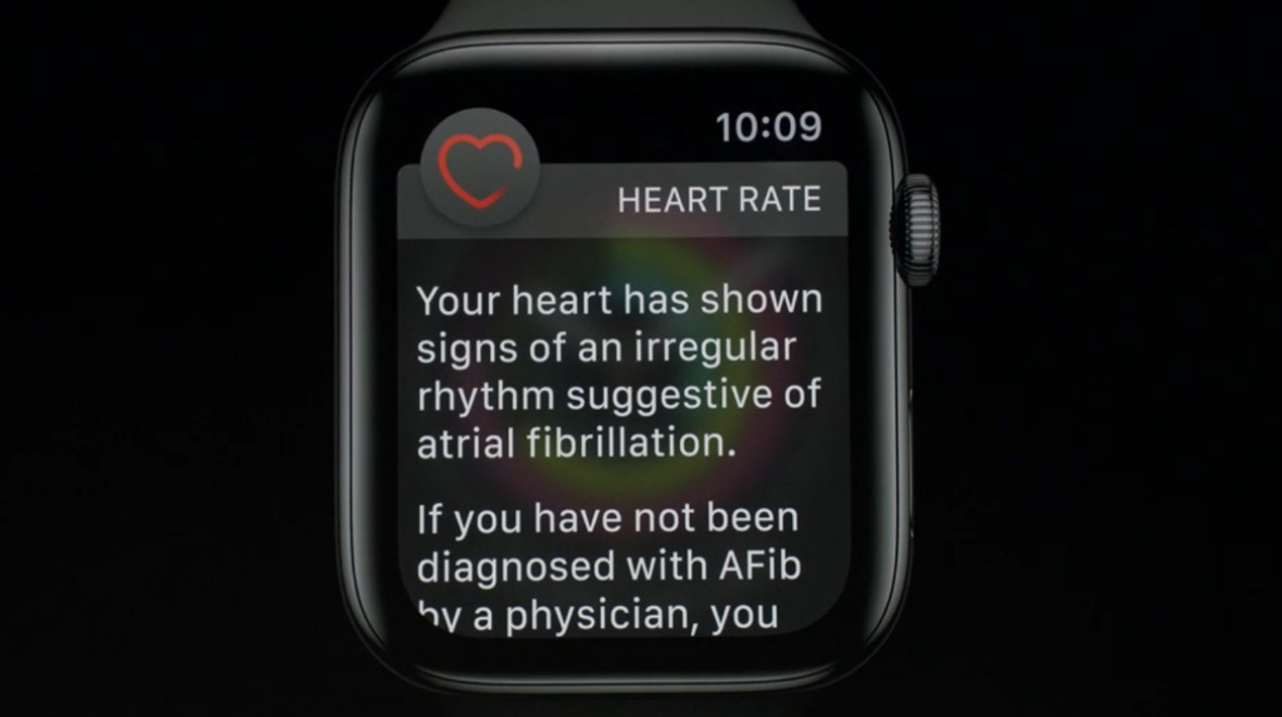 And finally: Apple Watch Series 4 detects AFib with 98% accuracy, says ...